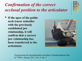 Gothic arch tracing.ppt by Dr kavan doshi | PPT