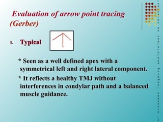 Gothic arch tracing.ppt by Dr kavan doshi | PPT