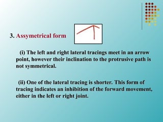 Gothic arch tracing.ppt by Dr kavan doshi | PPT