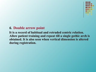 Gothic arch tracing.ppt by Dr kavan doshi | PPT