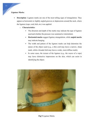 Forenisc study of Strangulation BY Chirag Dhankhar | DOCX