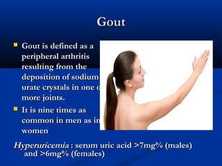 Gout 13 | PPT