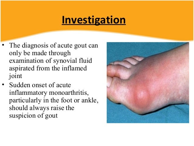 Gout