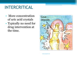 Gout | PPTX