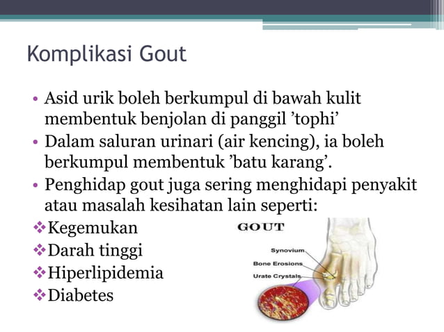 Gout | PPTX