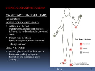 Gout | PPT