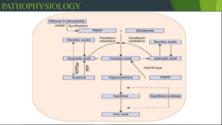 Gout(inflammatory joint disease) | PPTX