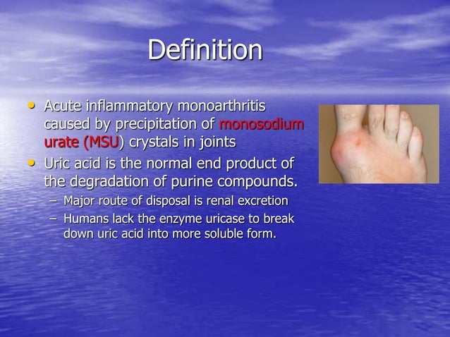 Gout | PPTX | Bone and Joint Conditions | Diseases and Conditions
