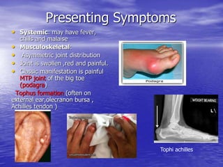 Gout | PPTX