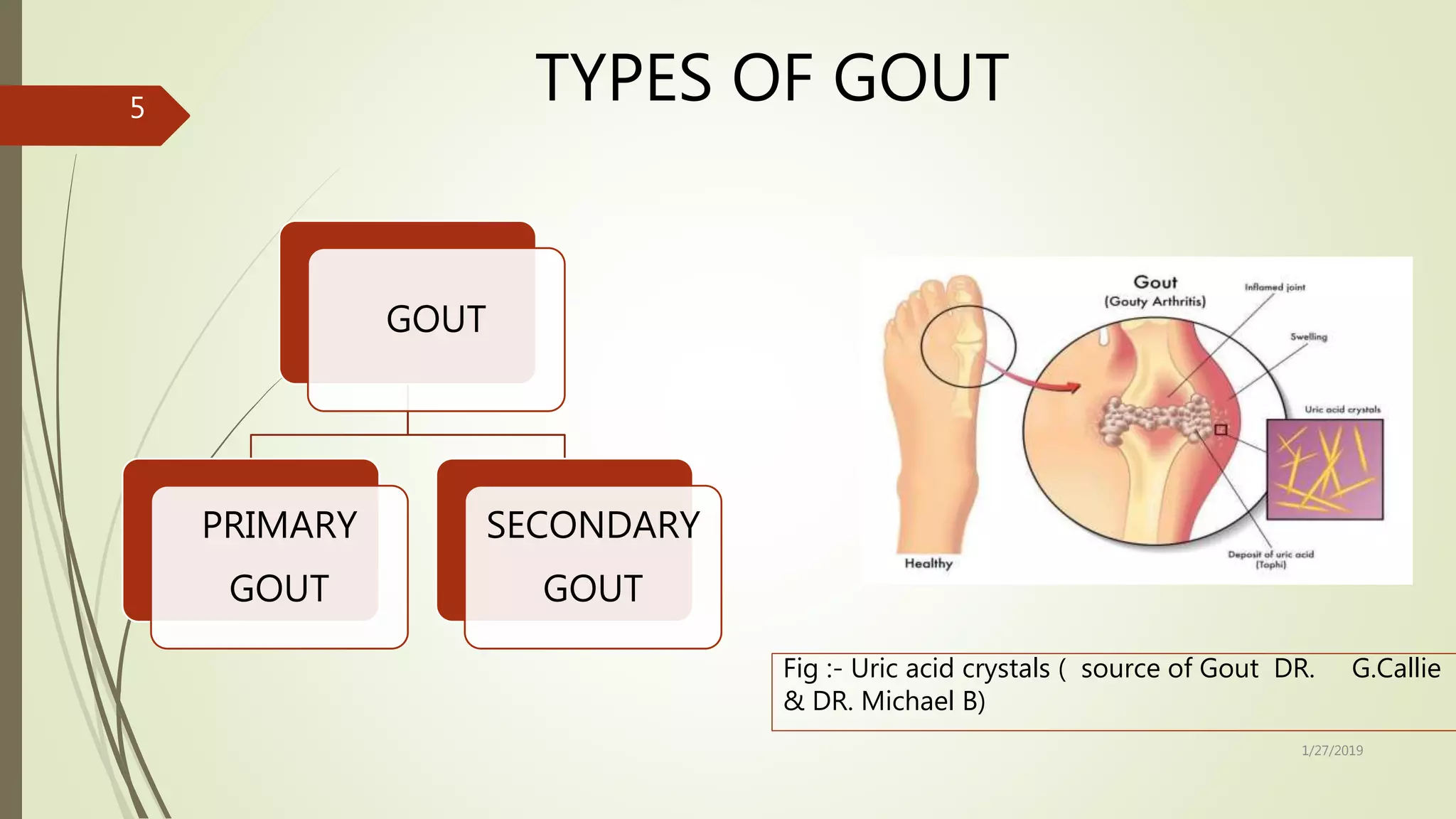 pathology & treatment of Gout | PPTX