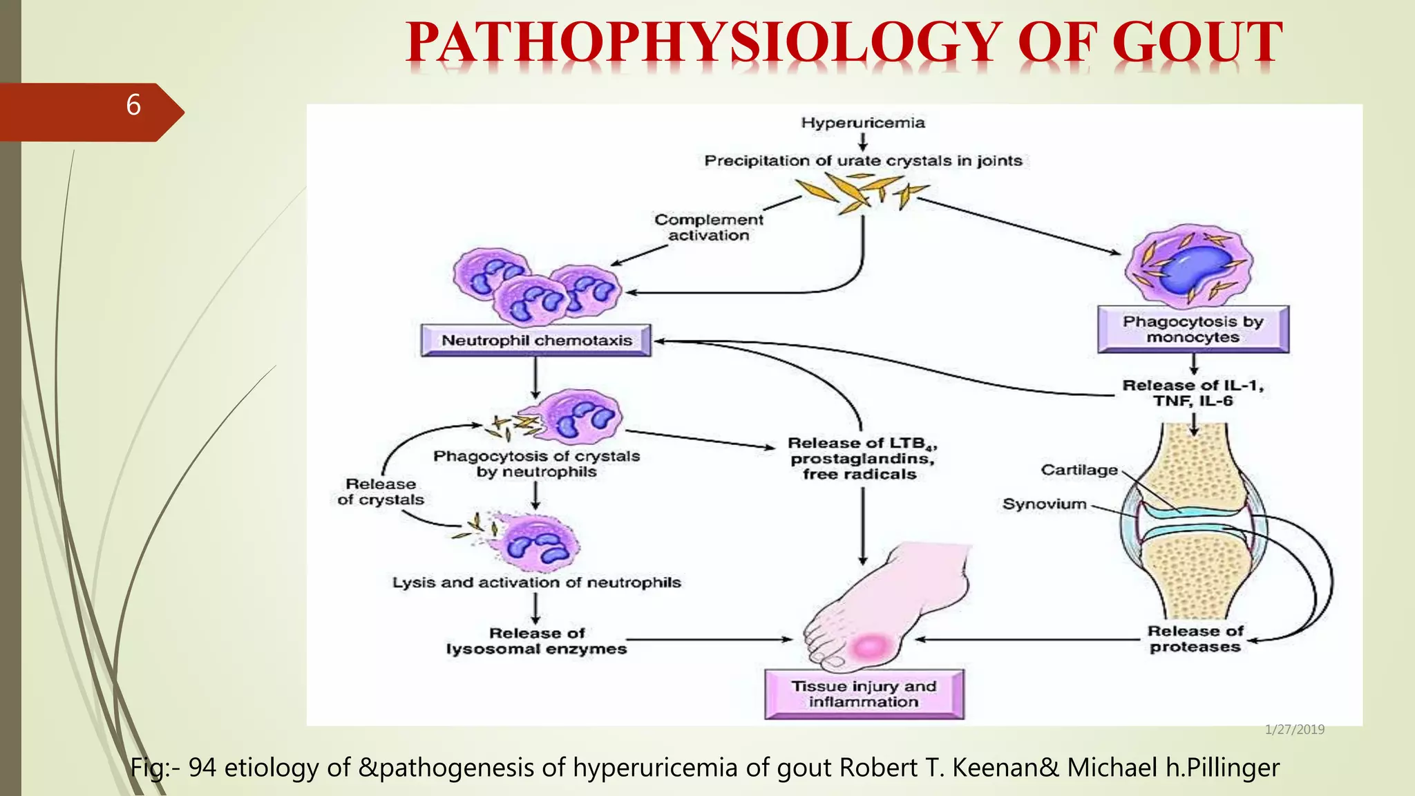 pathology & treatment of Gout | PPTX