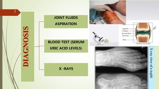 pathology & treatment of Gout | PPTX