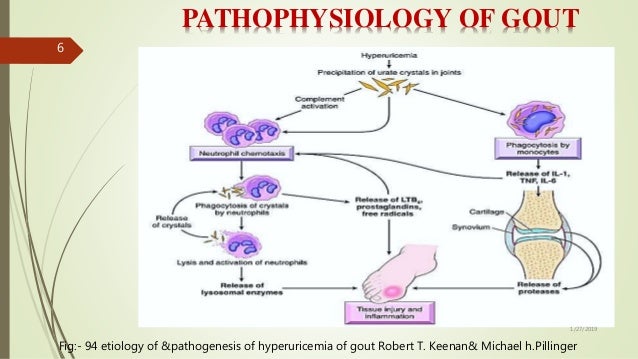 pathology & treatment of Gout