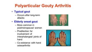Gout | PPT