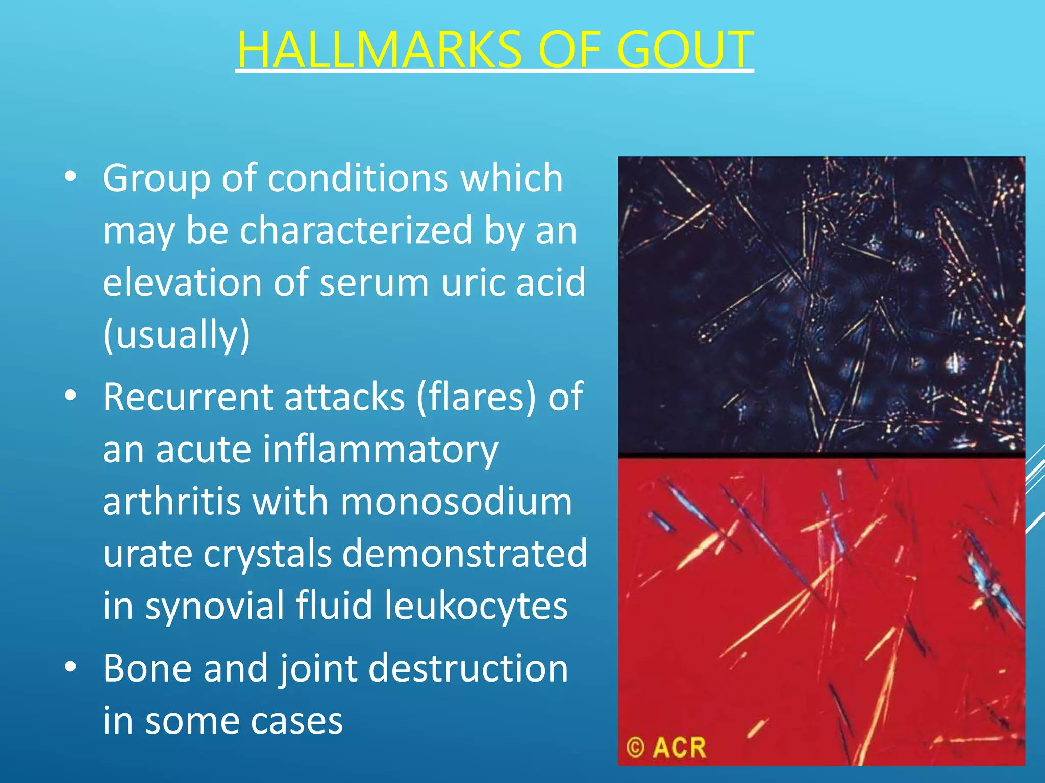 Gout - Clinical features , diagnosis and management | PPTX