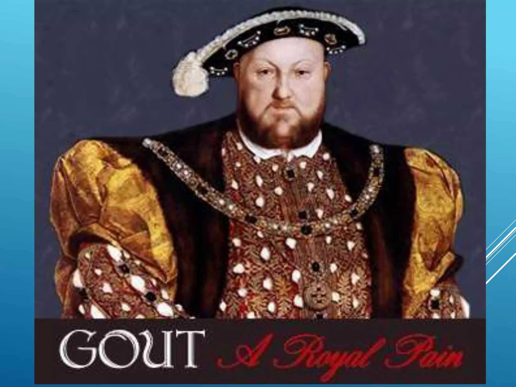 Gout - Clinical features , diagnosis and management | PPTX