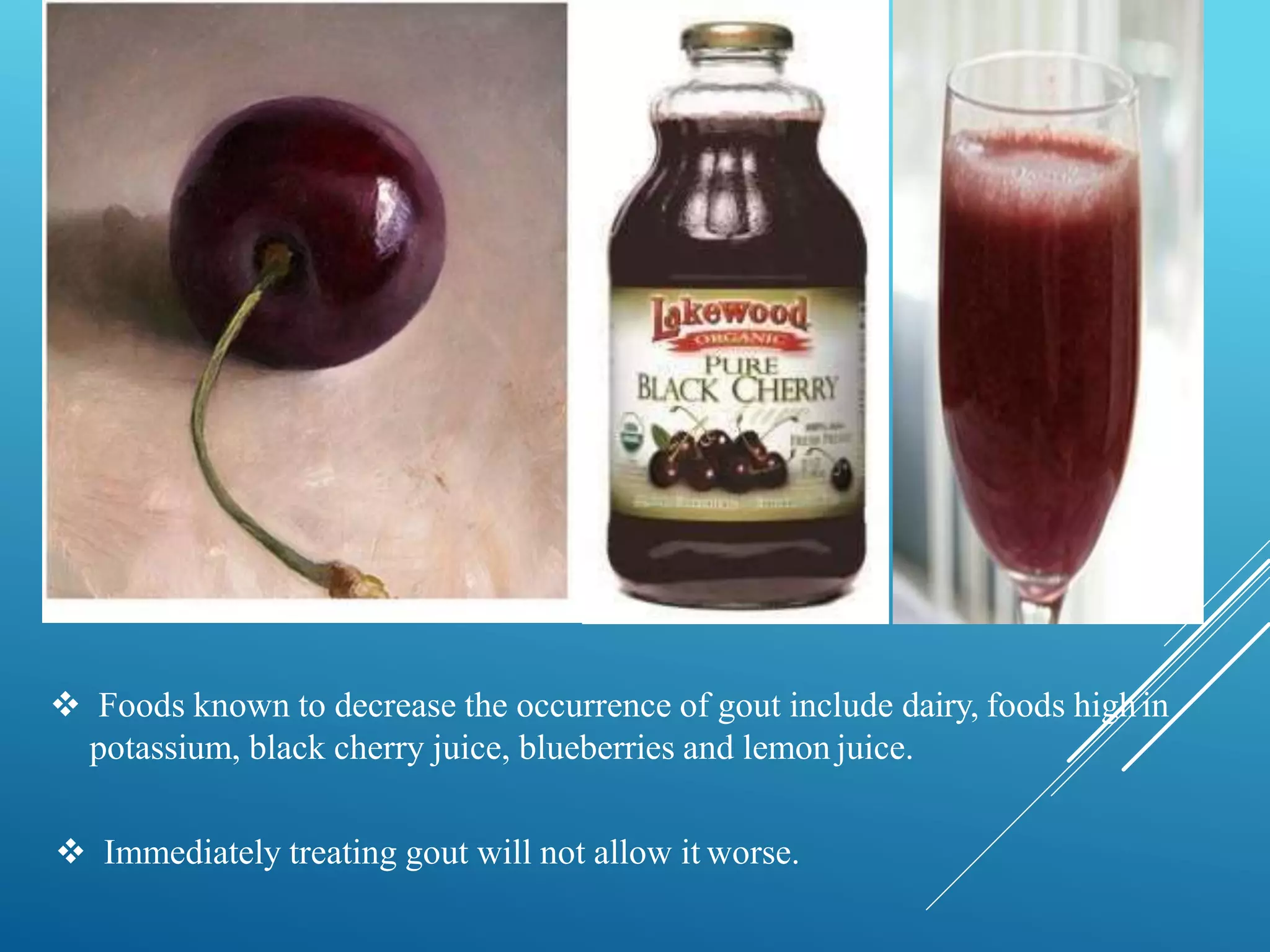 Gout - Clinical features , diagnosis and management | PPTX