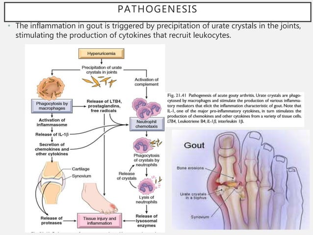 Pathophysiology of Gout | PPTX | Endocrine and Metabolic Diseases | Diseases and Conditions