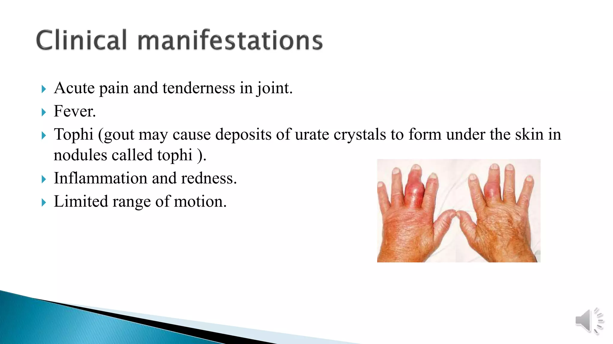 Gout (Musculoskeletal Disorders) | PPTX