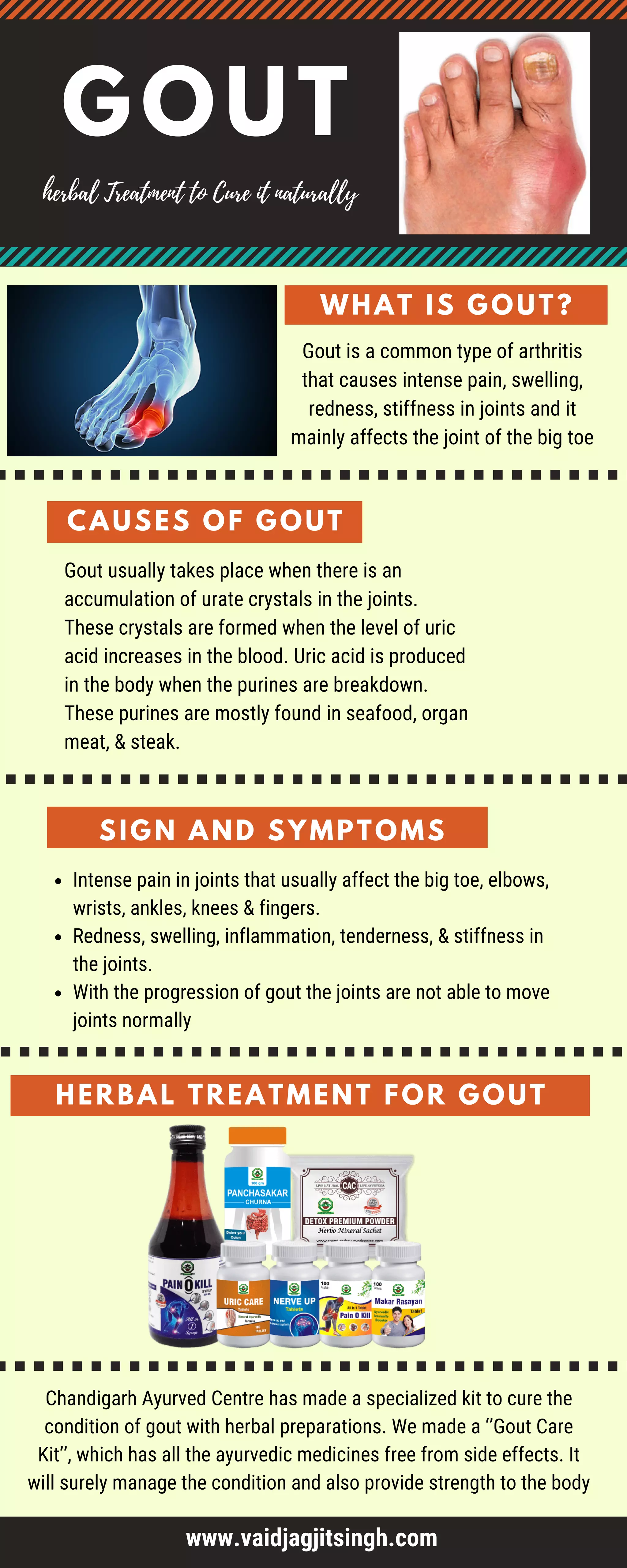 Gout - Causes, Symptoms and Herbal Treatment | PDF