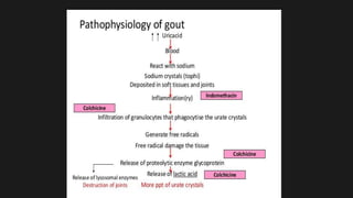 Gout | PPTX