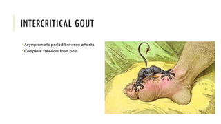 Gouty Arthritis | PDF