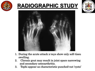 gout.pptx