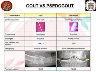 gout.pptx