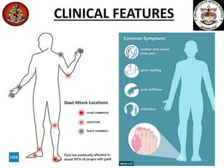 gout.pptx