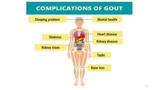 GOUT | PPT