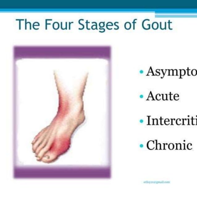 Gout.pptx