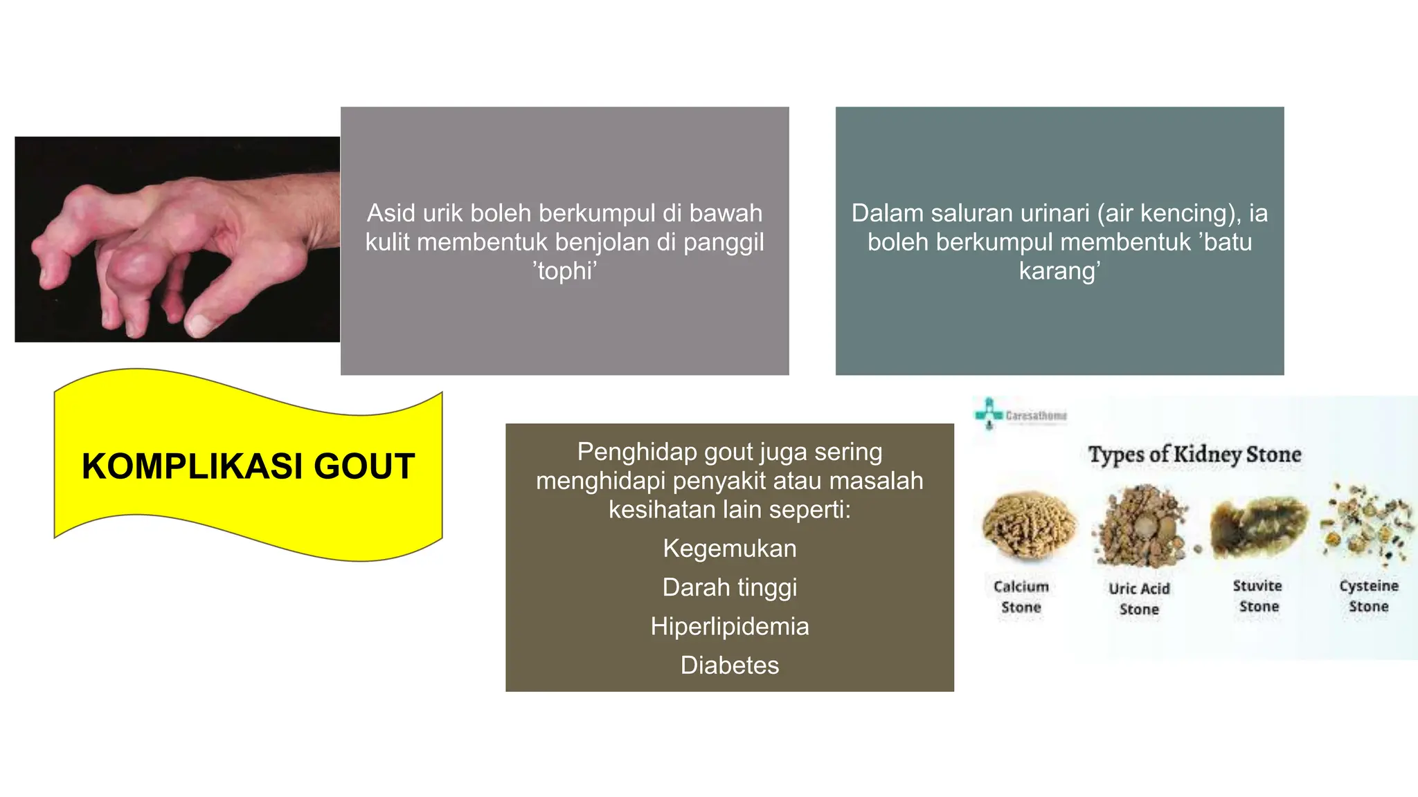 PENYAKIT GOUT PADA ORANG DEWASA DAN CARA-CARA MENGATASI.pptx