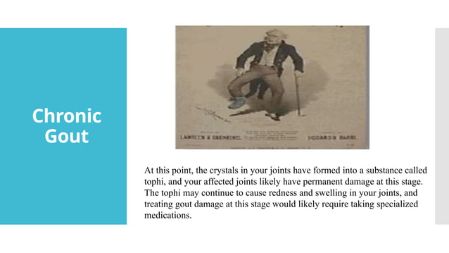 Gout: Understanding, Preventing, and Managing a Common Form of ...