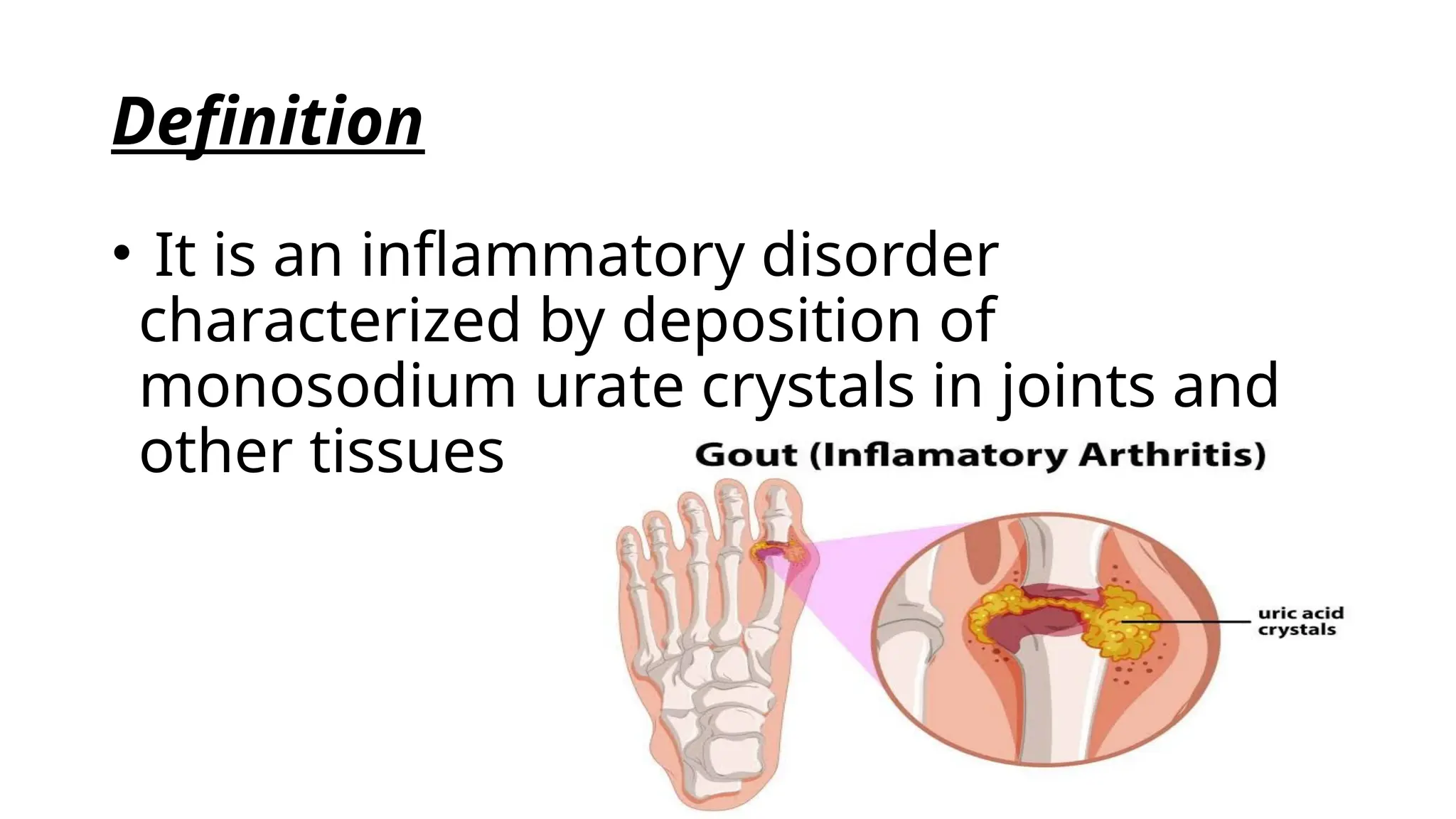 GOUT.definition, causes, pathogenesis, risk factor, clinical features ...