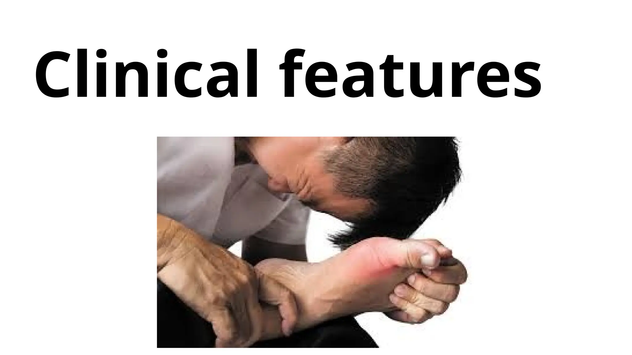 GOUT.definition, causes, pathogenesis, risk factor, clinical features ...