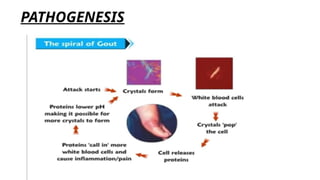 GOUT.definition, causes, pathogenesis, risk factor, clinical features ...