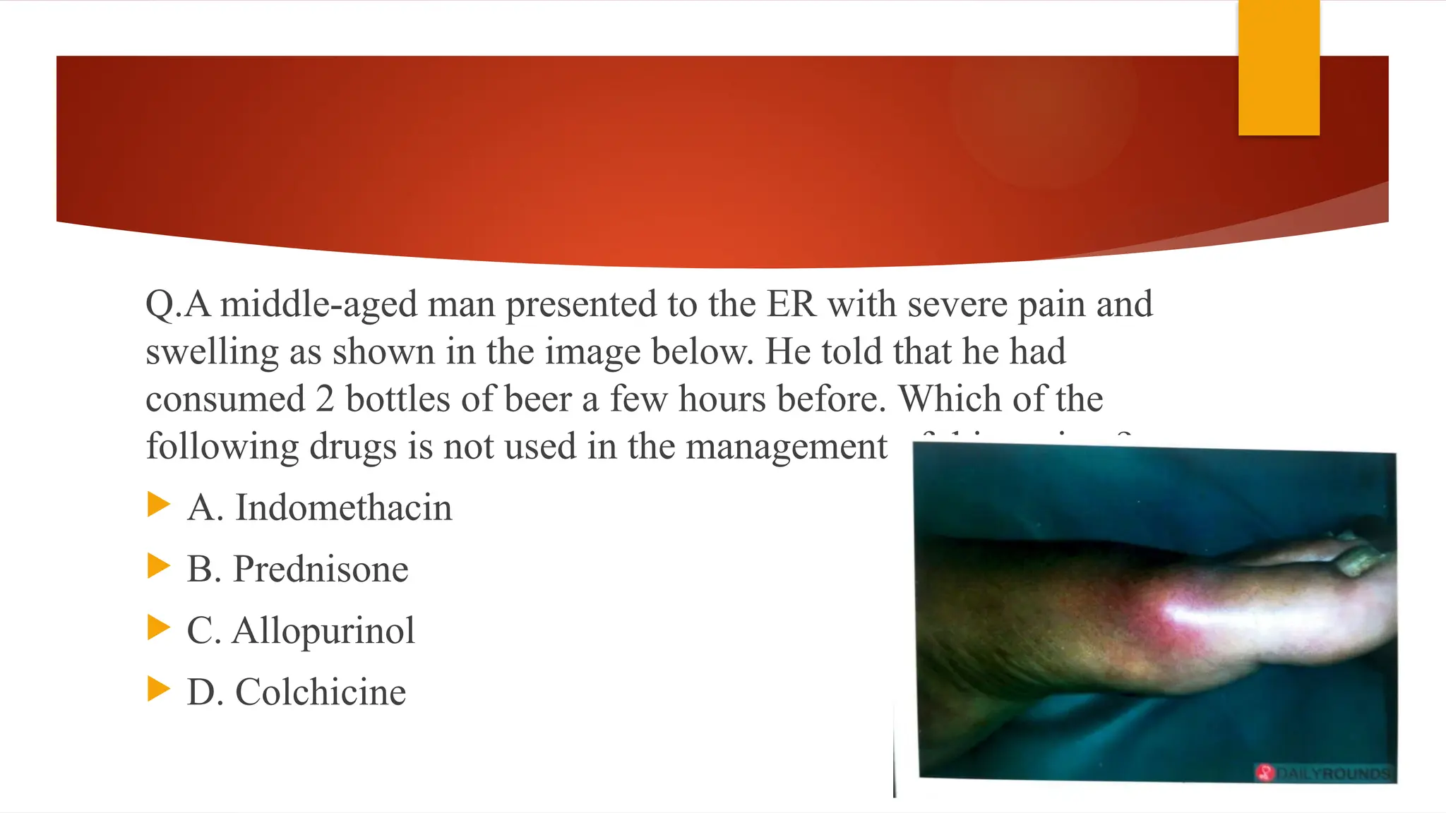 GOUT Definition Pathogenesis Clinical Features Treatment | PPT | Free ...