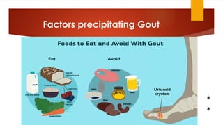 GOUT Definition Pathogenesis Clinical Features Treatment | PPT