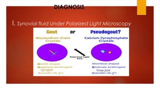 GOUT Definition Pathogenesis Clinical Features Treatment | PPT