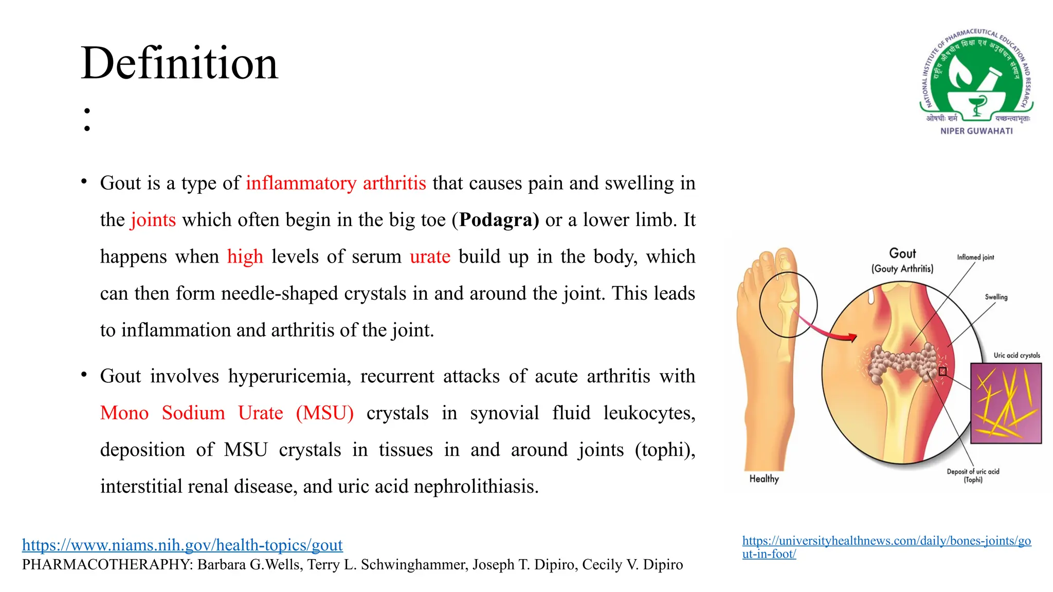 GOUT.pptx Gout is a type of inflammatory arthritis that causes pain and ...
