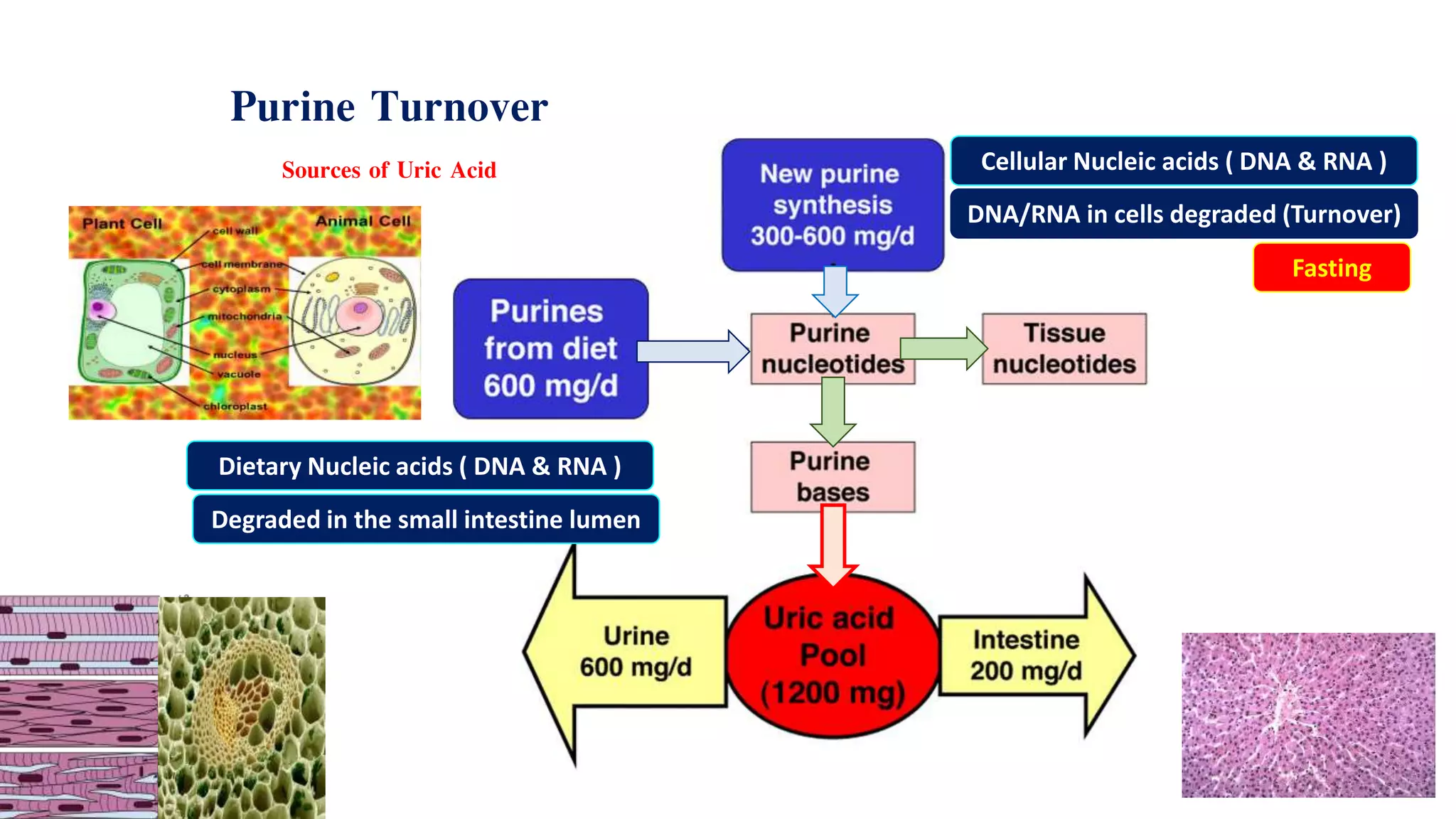 Gout hyperuricemia-classification-zagazig | PPTX