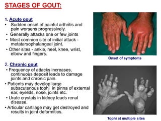 GOUT | PPT