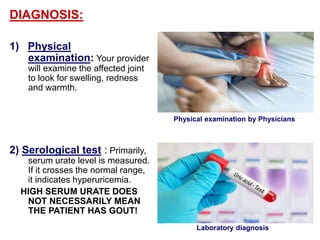 GOUT | PPT