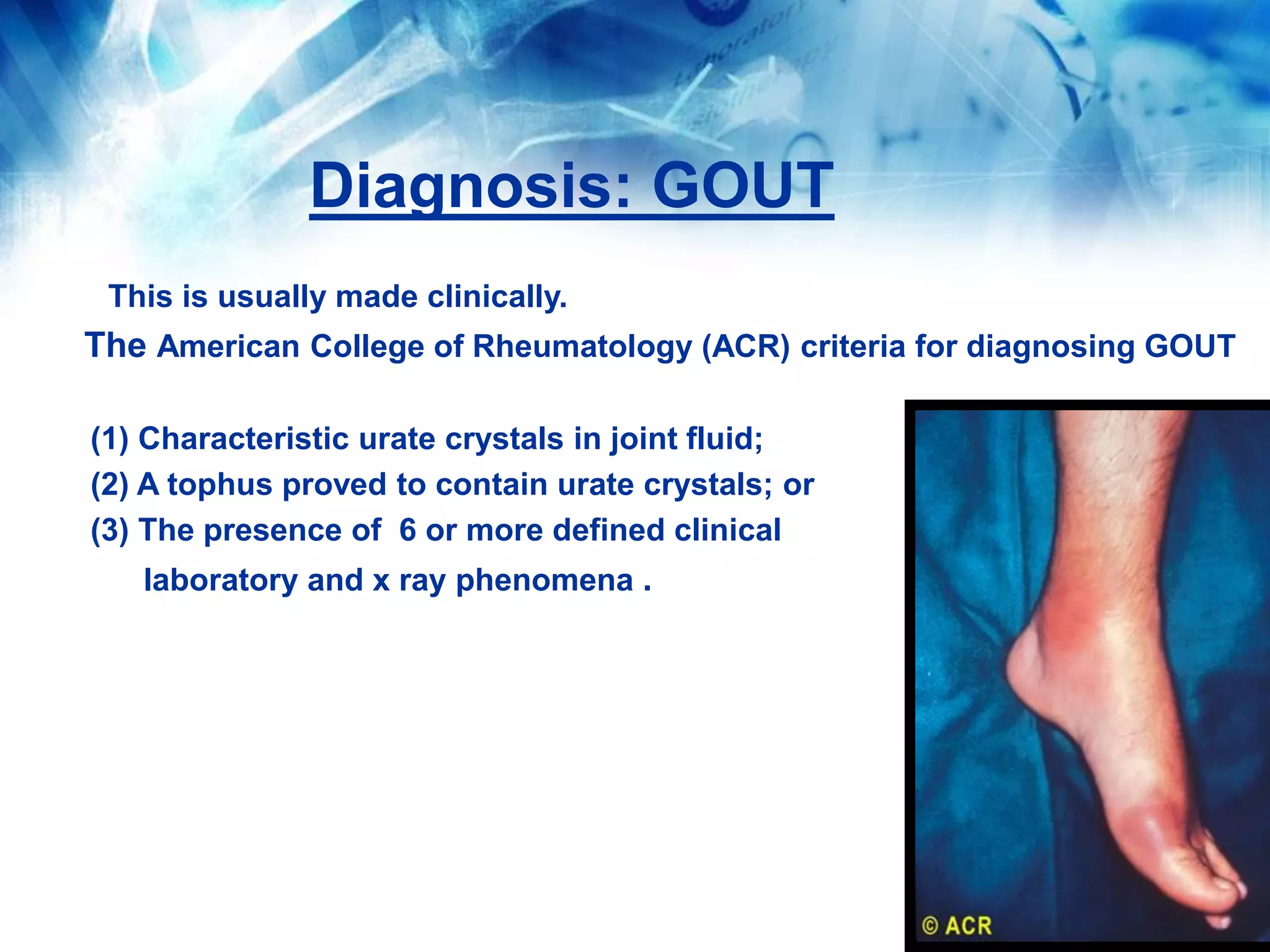 Gout Summery Updated 2020 American College Of Rheumatology Guideline | PDF
