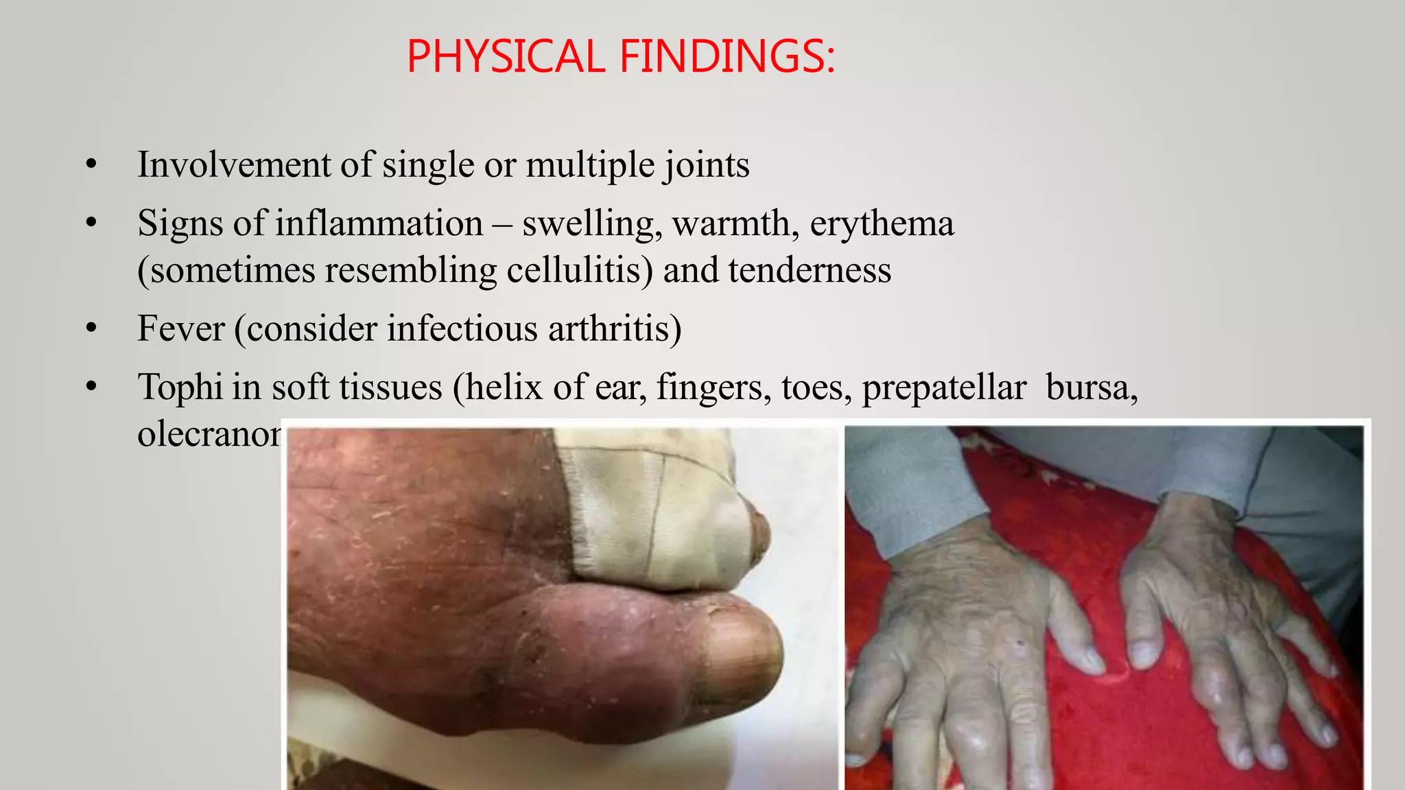 Gout and gouty arthritis.pptx