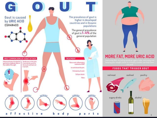 Gout and hyperuricemia | PPTX