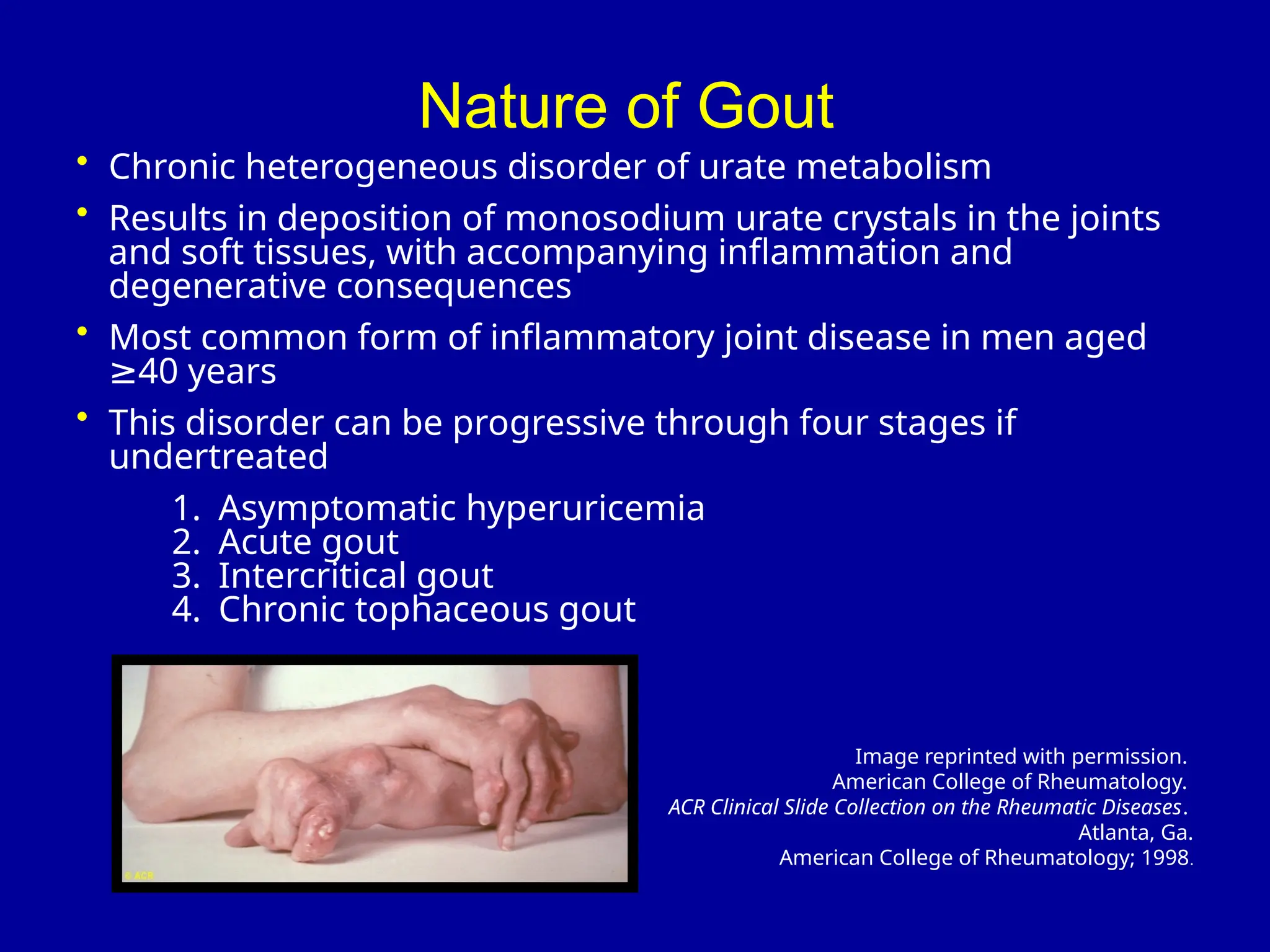 Gout disease 2025.pptx January pptdownload | PPT