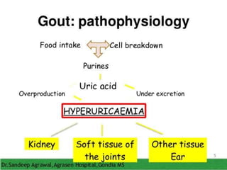 Gout disease (Imran khan salarzai) | PPT