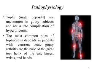 "Comprehensive Overview of Gout: Pathophysiology, Diagnosis, and ...