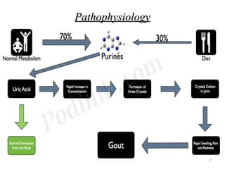 "Comprehensive Overview of Gout: Pathophysiology, Diagnosis, and ...